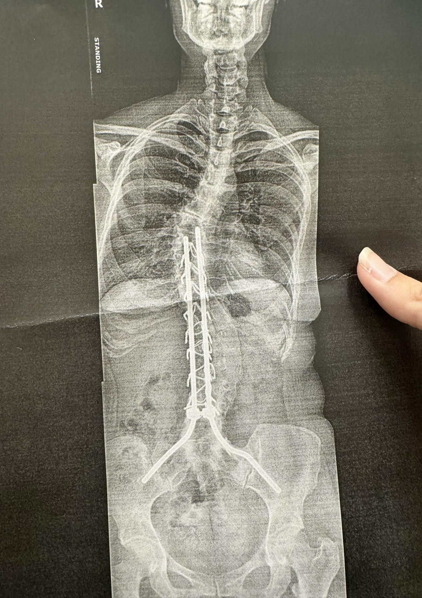 Sometimes I Remember What Bending My Spine Feels Like – caroline price